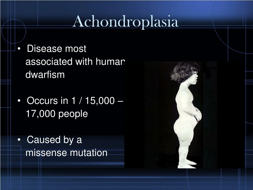 PPT - Achondroplasia: History, Genetics, and Treatment Options ...