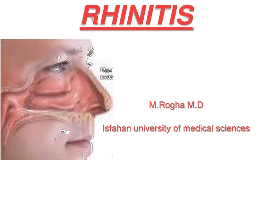 PPT - RHINITIS PowerPoint Presentation, free download - ID:9685154