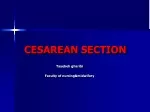 PPT - CESAREAN SECTION PowerPoint Presentation, free download - ID:4218589