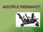PPT - Multiple pregnancy PowerPoint Presentation, free download - ID ...