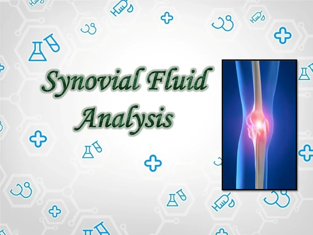 PPT - Synovial Fluid Analysis PowerPoint Presentation, free download - ID:9706708