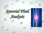 PPT - Synovial Fluid PowerPoint Presentation, free download - ID:702385