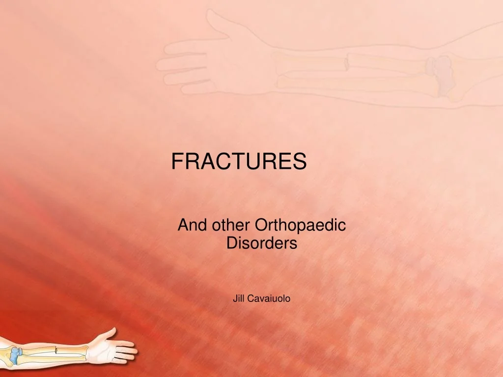 PPT - FRACTURES PowerPoint Presentation, free download - ID:9719153
