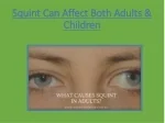 PPT - SQUINT PowerPoint Presentation, free download - ID:6195848